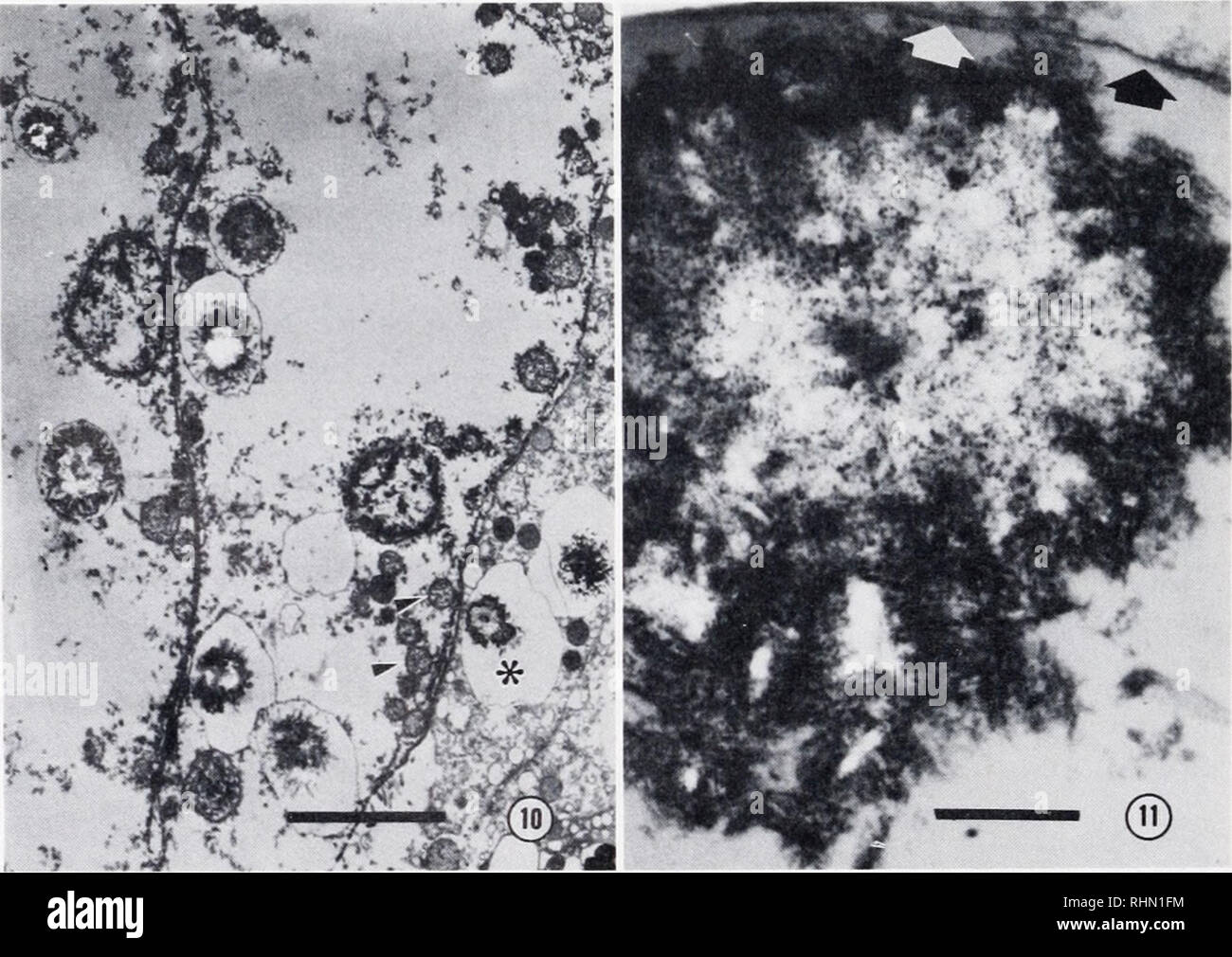 Transmission Electron Microscopy High Resolution Stock Photography and ...