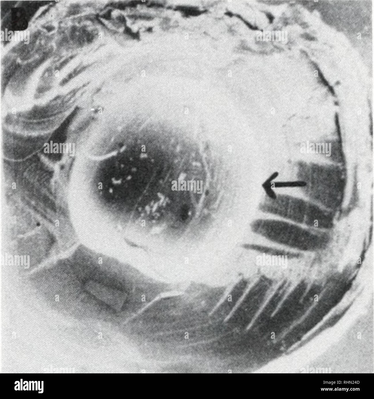 Lens nucleus hi-res stock photography and images - Alamy