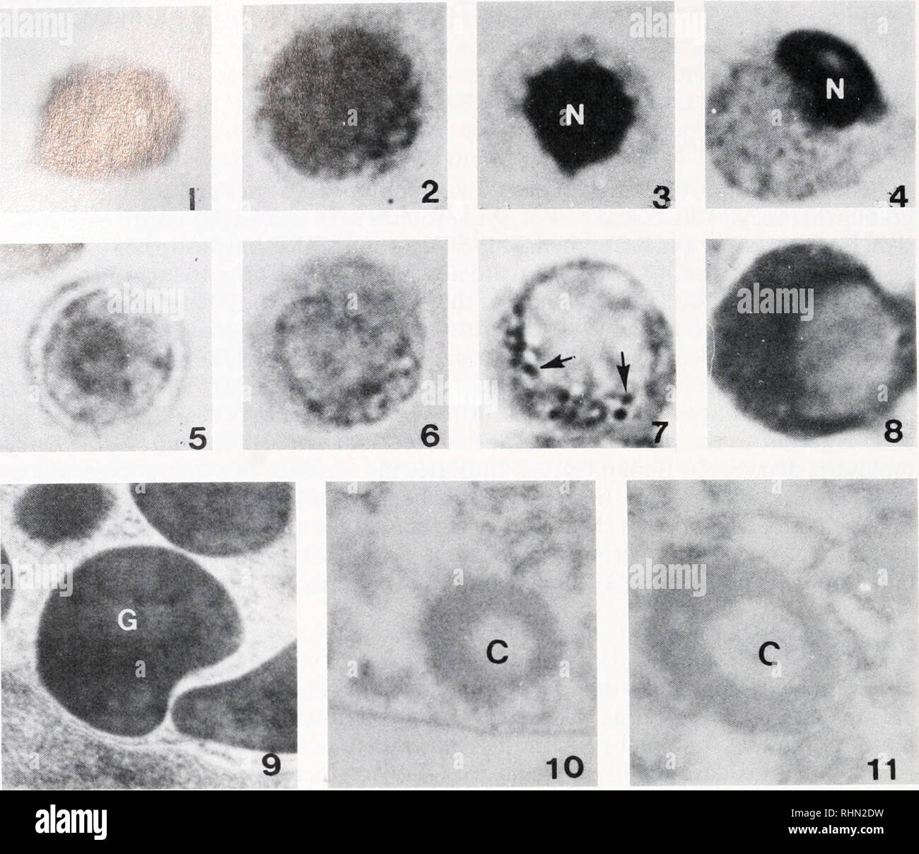 Agranular hi-res stock photography and images - Alamy
