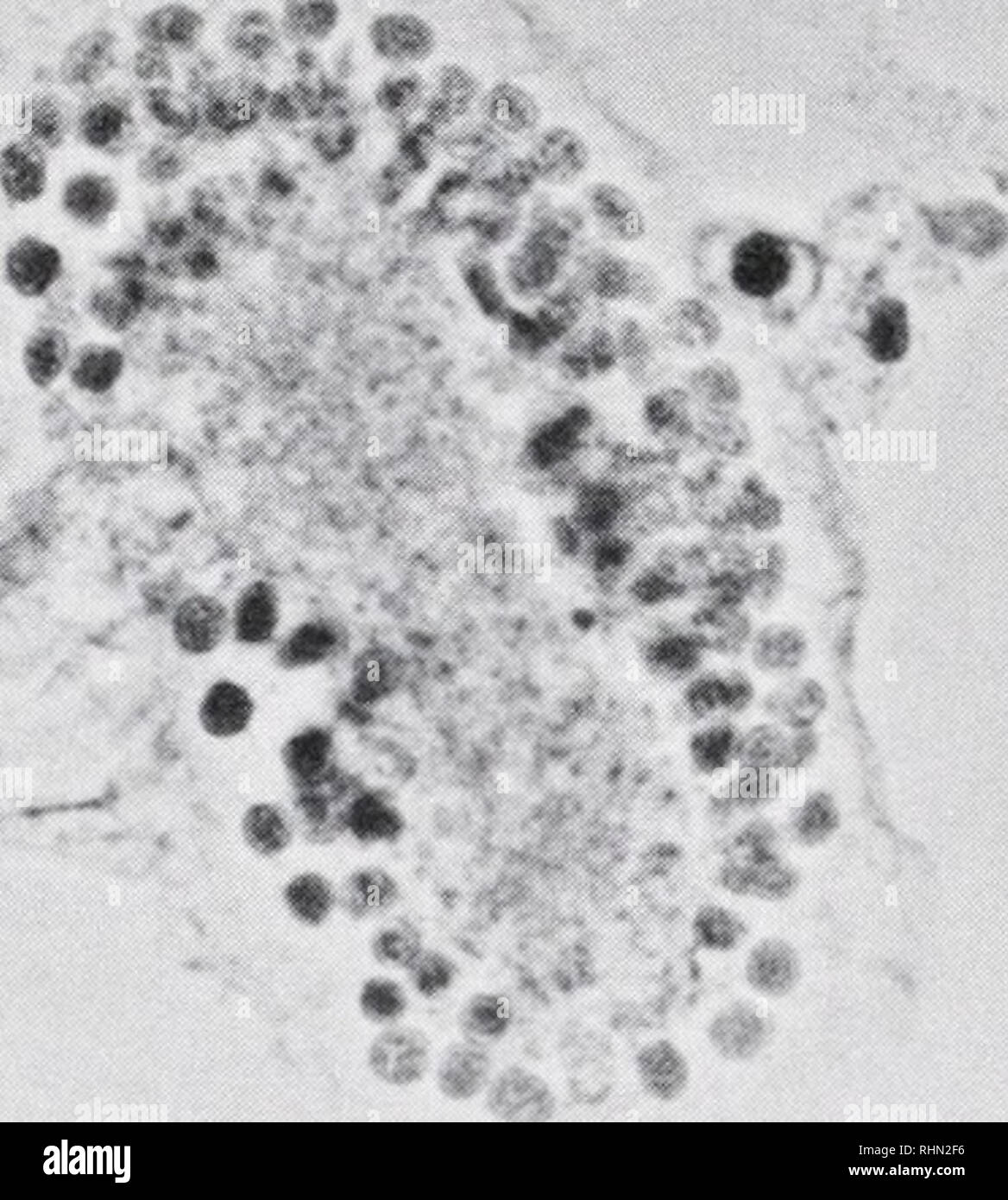 Cytoplasmic inclusions hi-res stock photography and images - Alamy