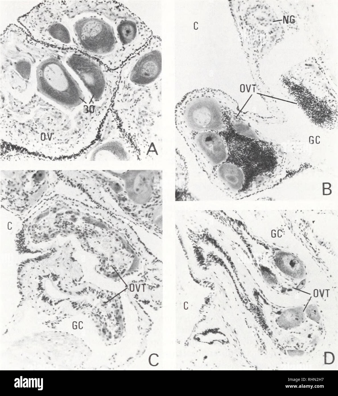 Ovotestis hi-res stock photography and images - Alamy