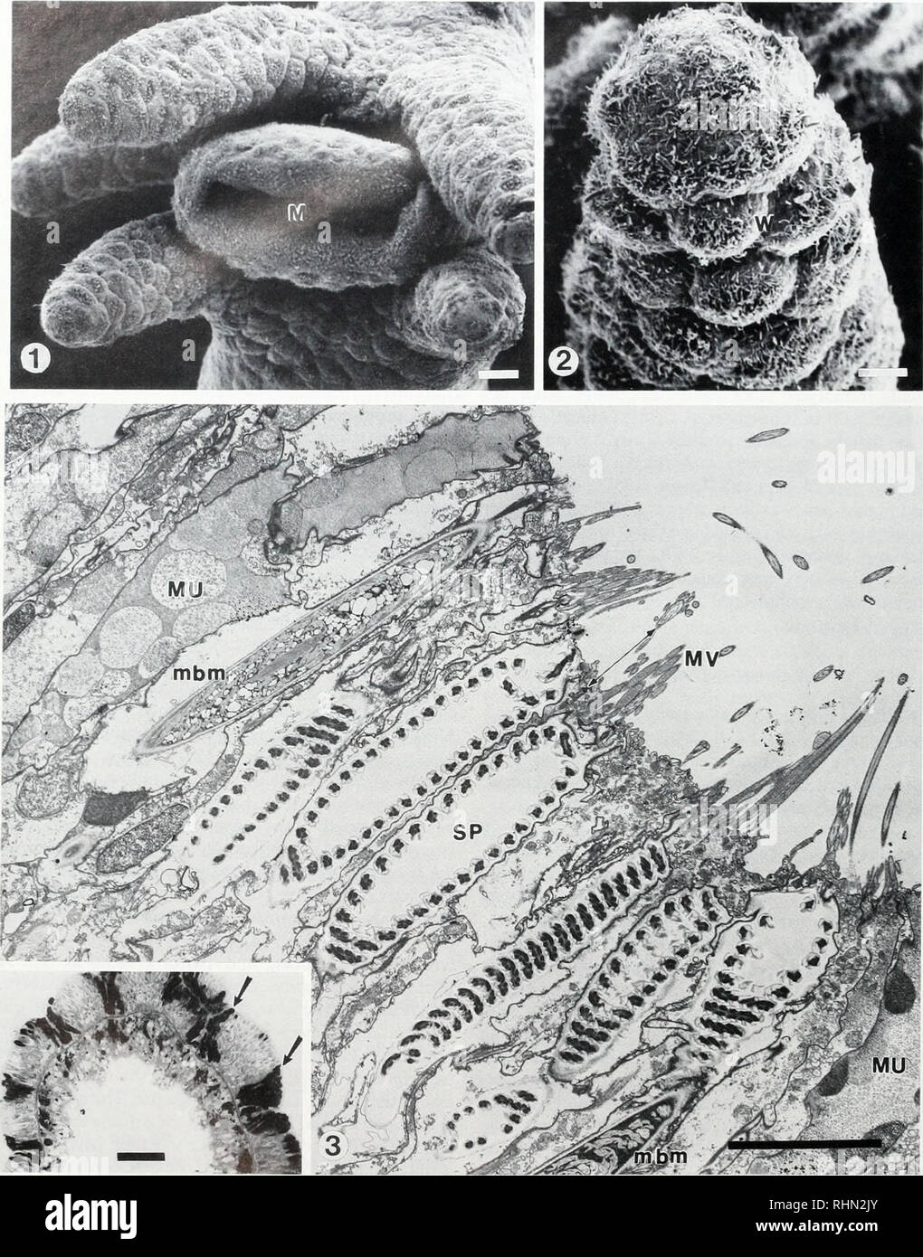 Polyp structures hi-res stock photography and images - Alamy