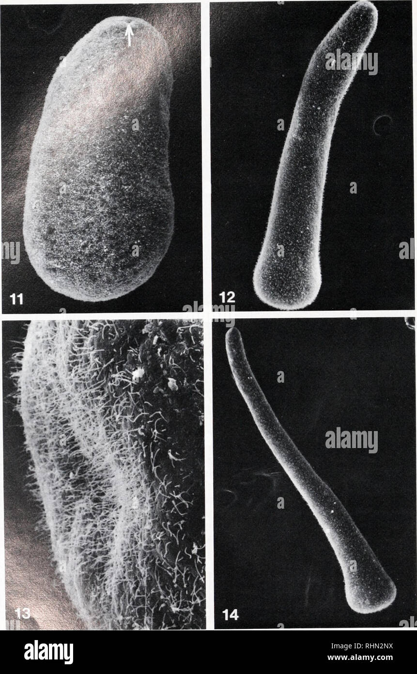 Cilia micrograph hi-res stock photography and images - Alamy