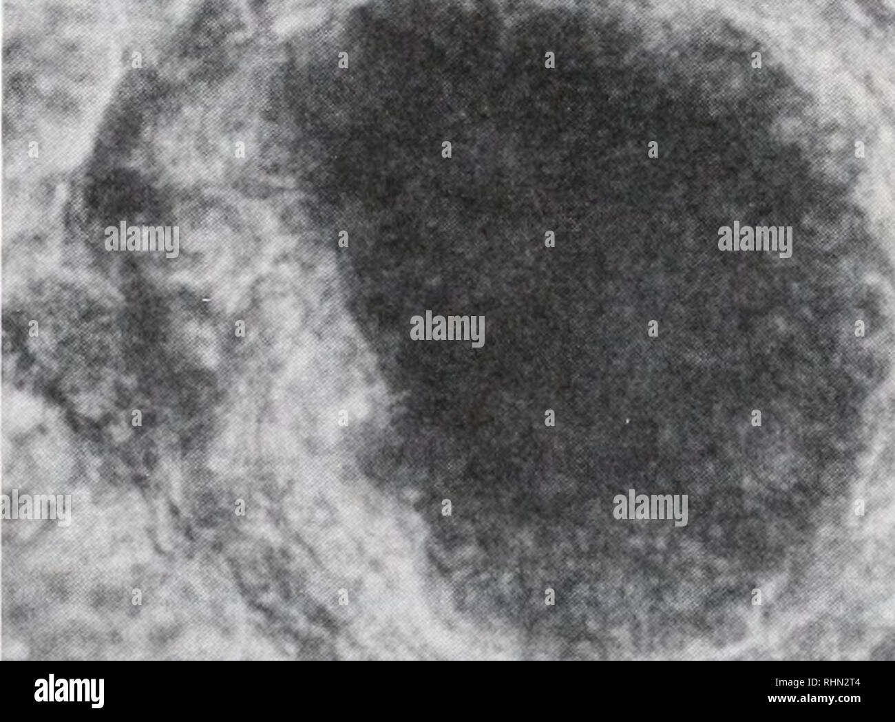 Gambierdiscus toxicus hi-res stock photography and images - Alamy