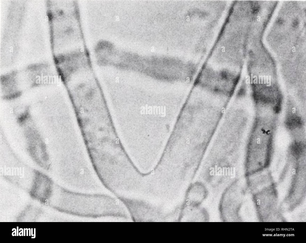 Mass fungal infection hi-res stock photography and images - Alamy