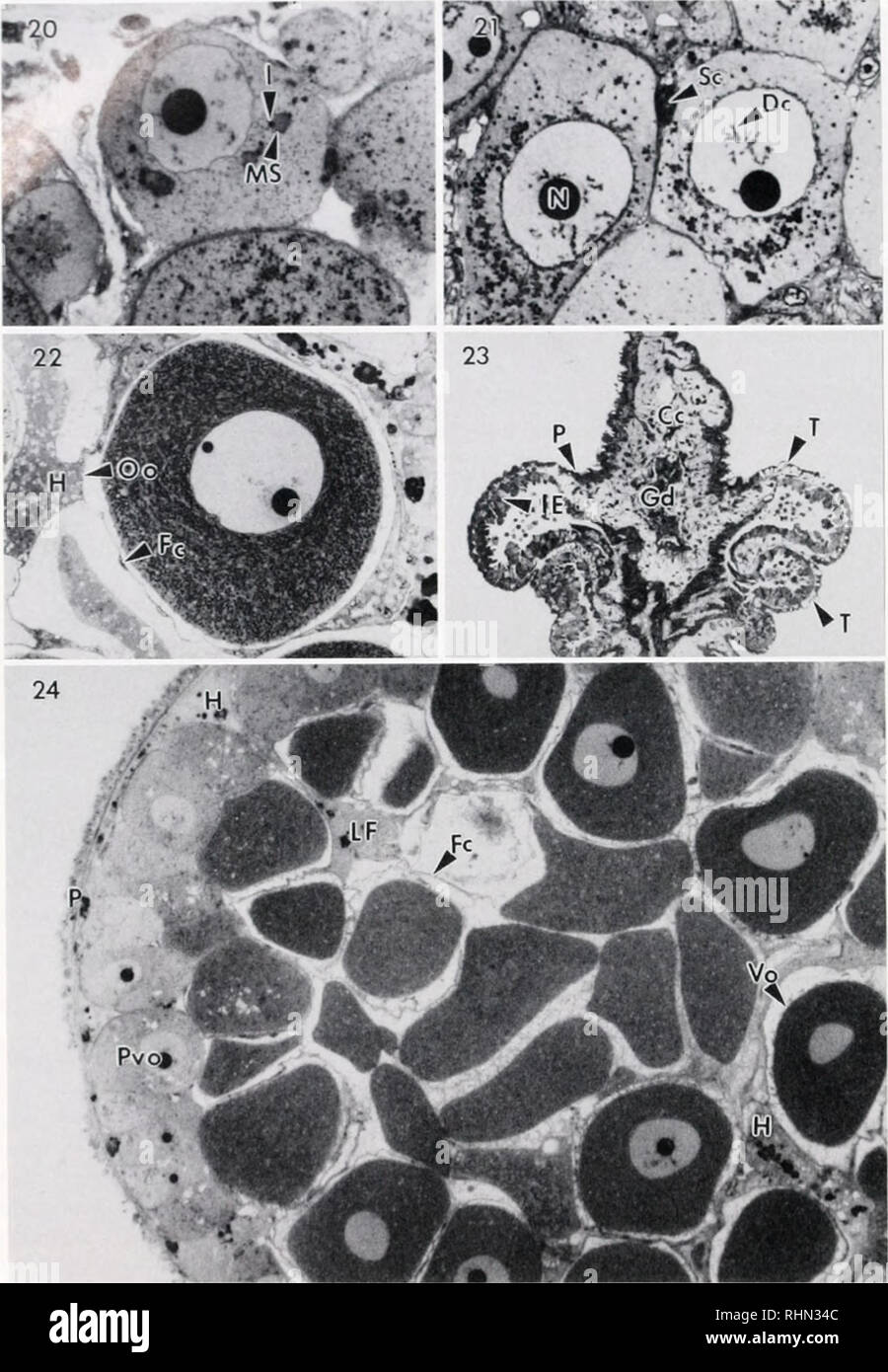 Connective tissue light micrograph hi-res stock photography and images ...