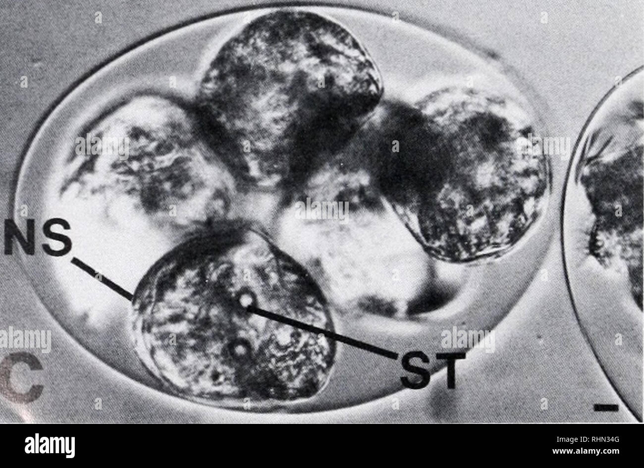 Statocyst hi-res stock photography and images - Alamy