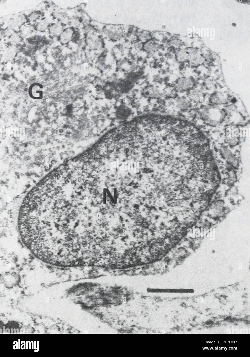 Plasma cell micrograph hi-res stock photography and images - Alamy