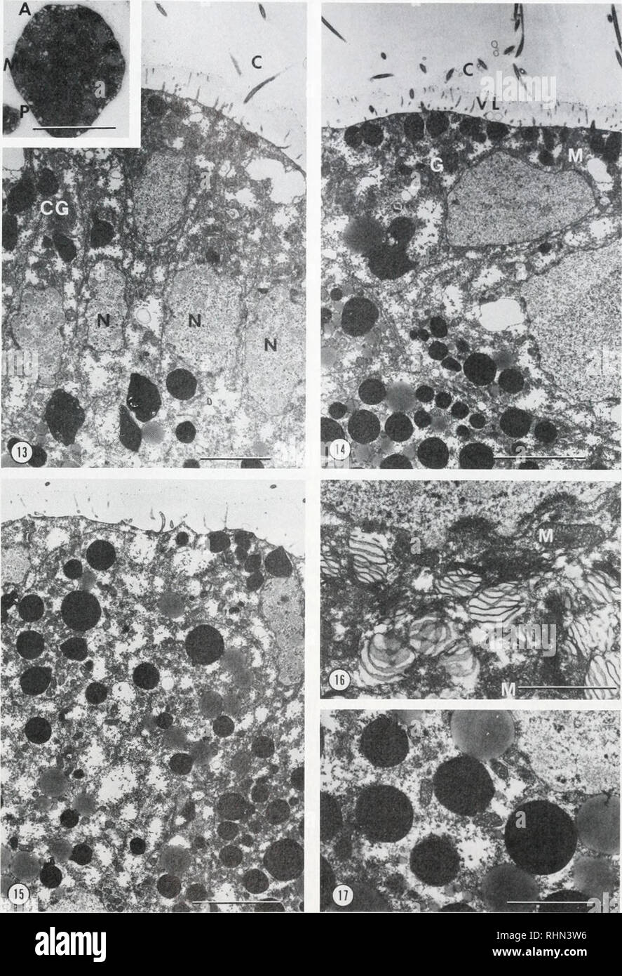 Cilia electron micrograph hi-res stock photography and images - Alamy