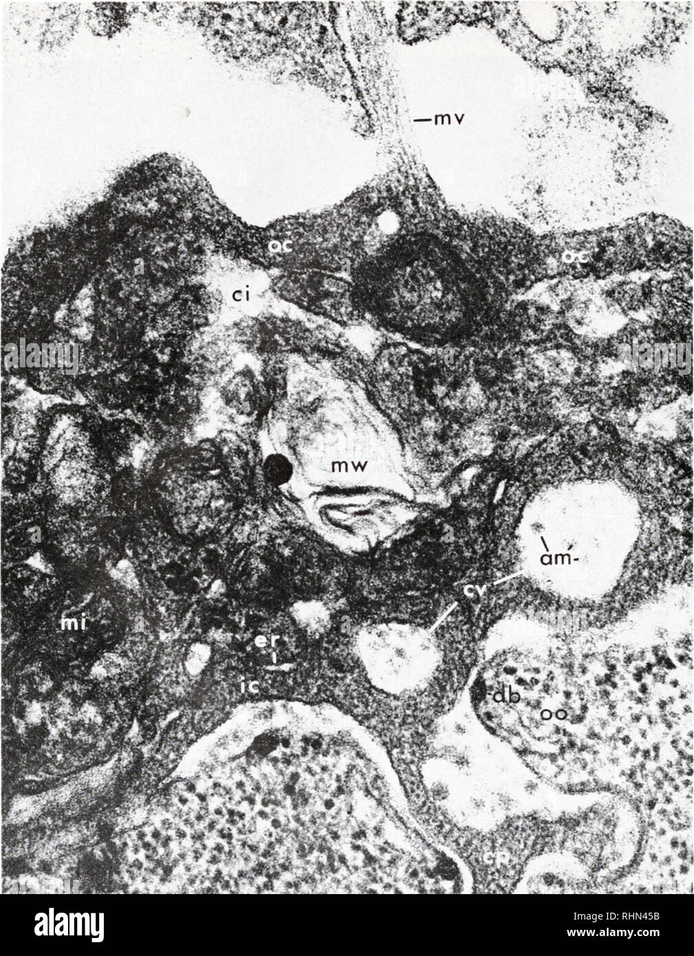 Microvilli electron micrograph hi-res stock photography and images - Alamy