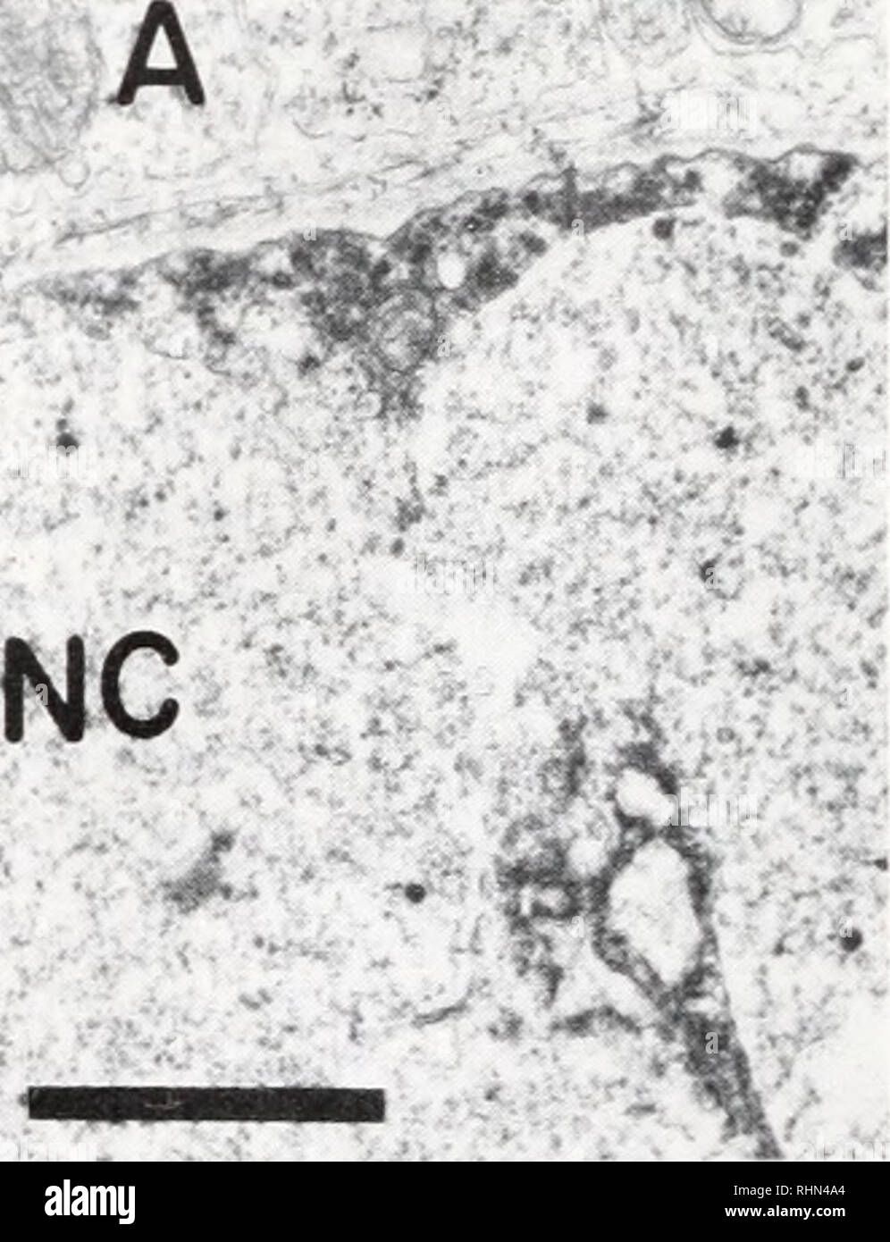 Nerve cell electron micrograph hi-res stock photography and images - Alamy