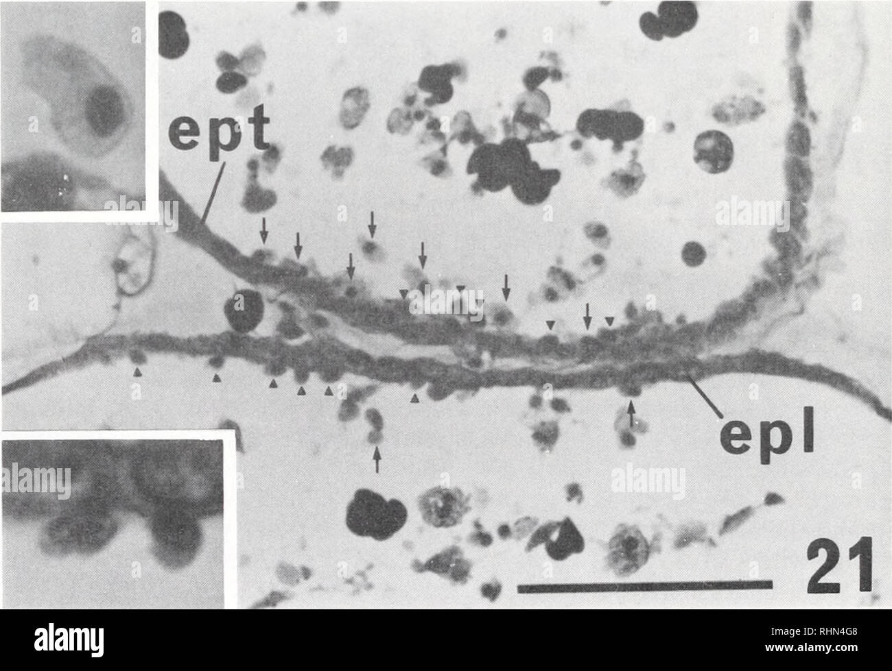 Fusibility hi-res stock photography and images - Alamy