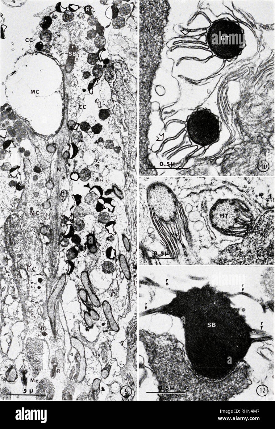 Granule nerve cell hi-res stock photography and images - Alamy