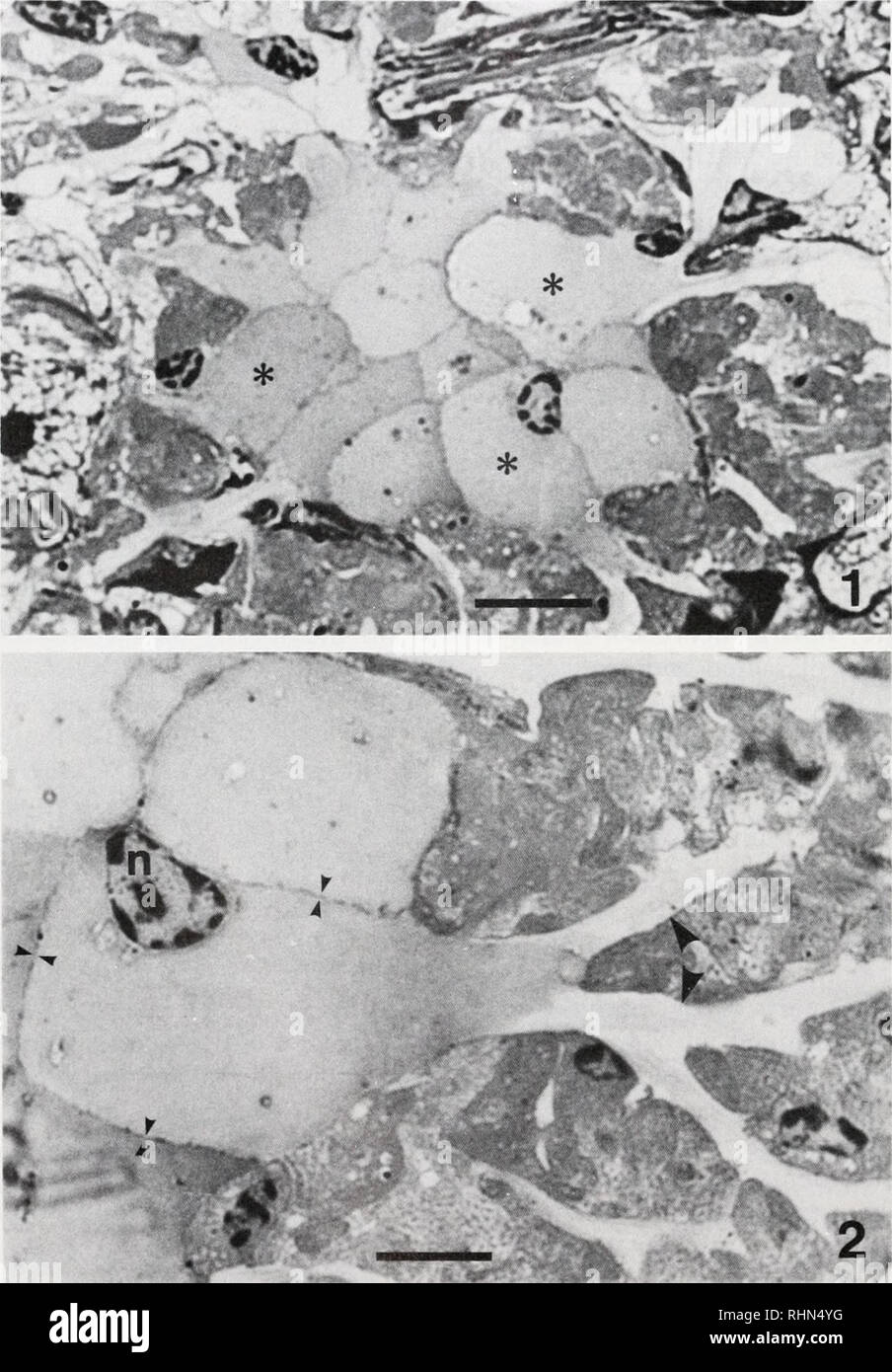 Chromatosome hi-res stock photography and images - Alamy