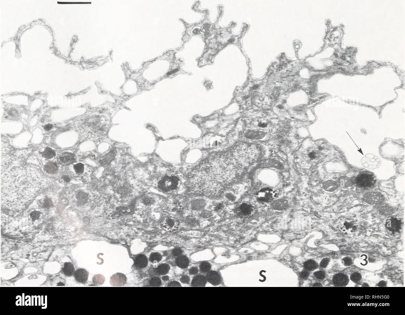 Melanin granules hi-res stock photography and images - Alamy