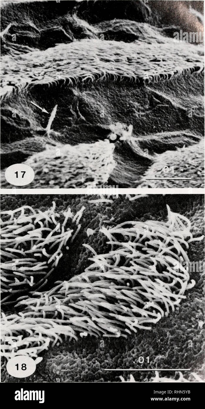 Embryo 16 cell stage hi-res stock photography and images - Alamy