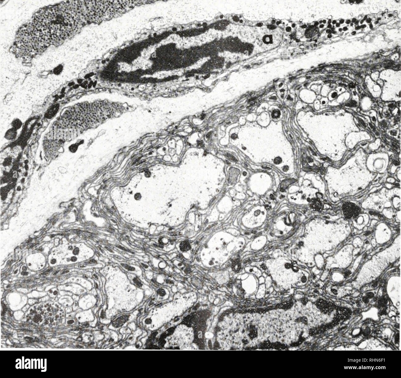 Nerve cells micrograph hi-res stock photography and images - Alamy