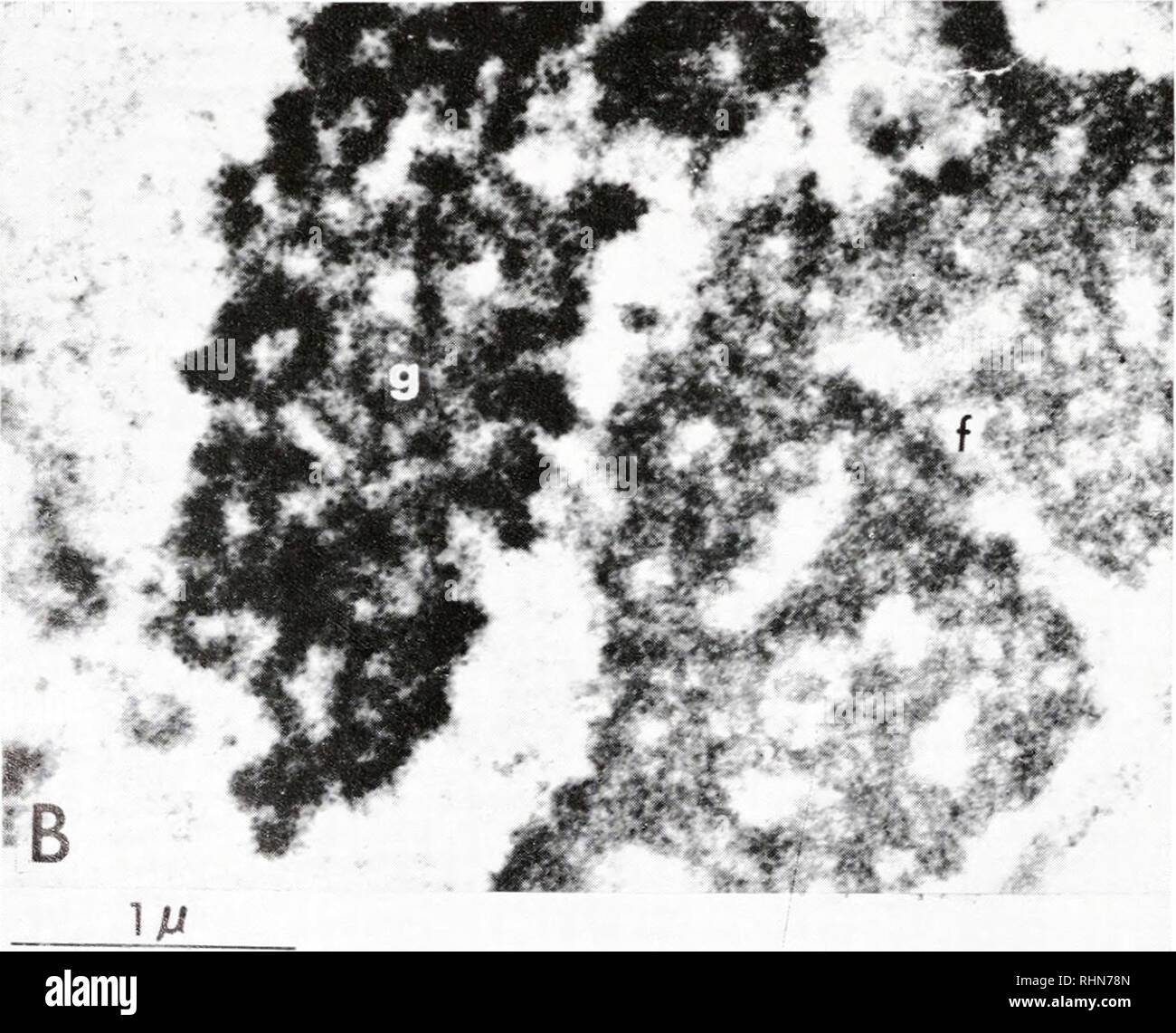 Centrioles Micrograph