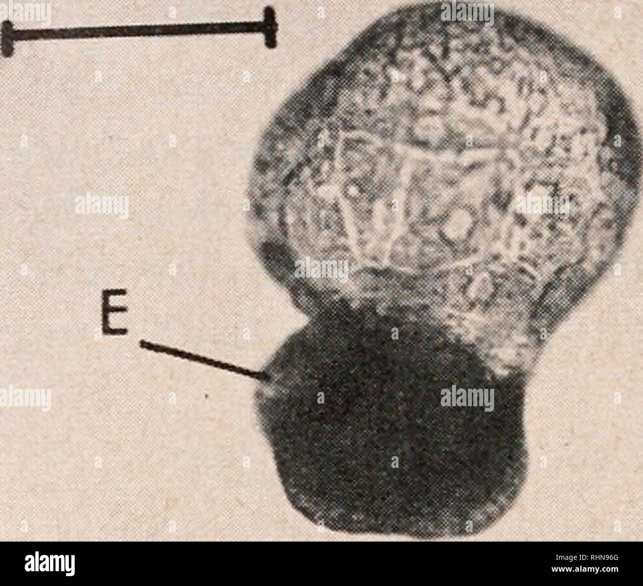 Cephalic space hi-res stock photography and images - Alamy