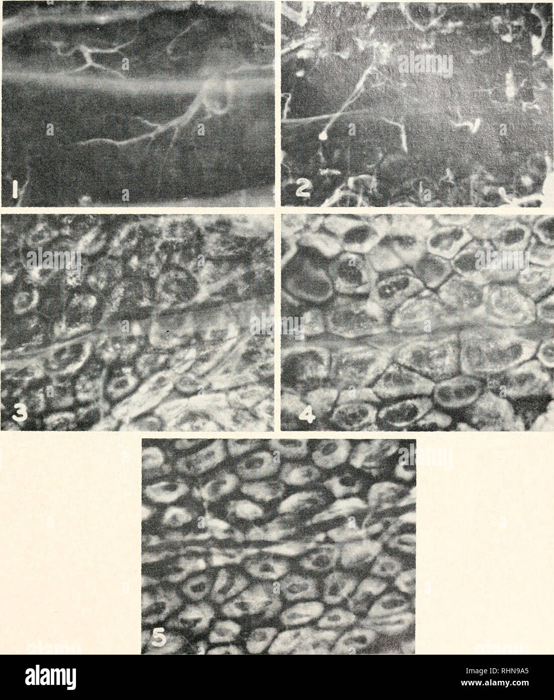 Secretory Stage High Resolution Stock Photography and Images - Alamy