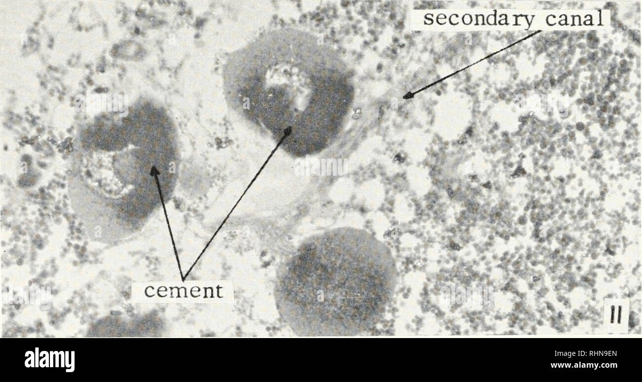 Gland Canals High Resolution Stock Photography and Images - Alamy