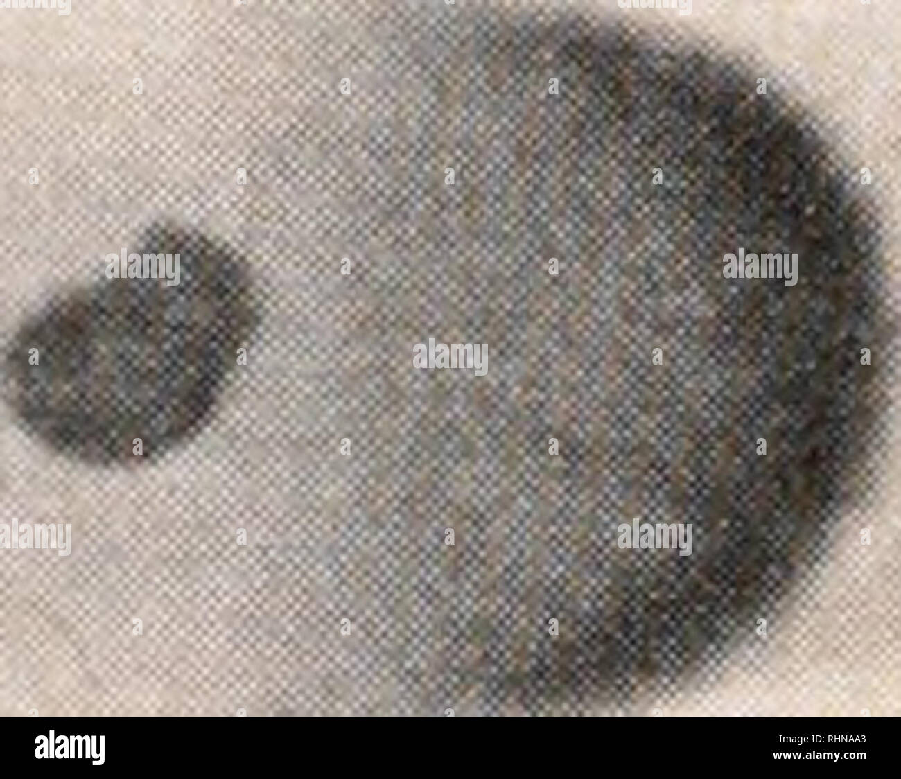 Haemolymph protein hi-res stock photography and images - Alamy