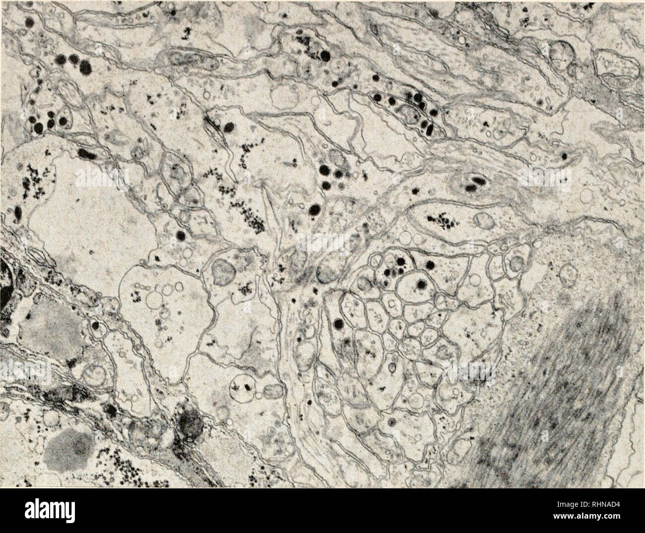 Dense core vesicles hi-res stock photography and images - Alamy