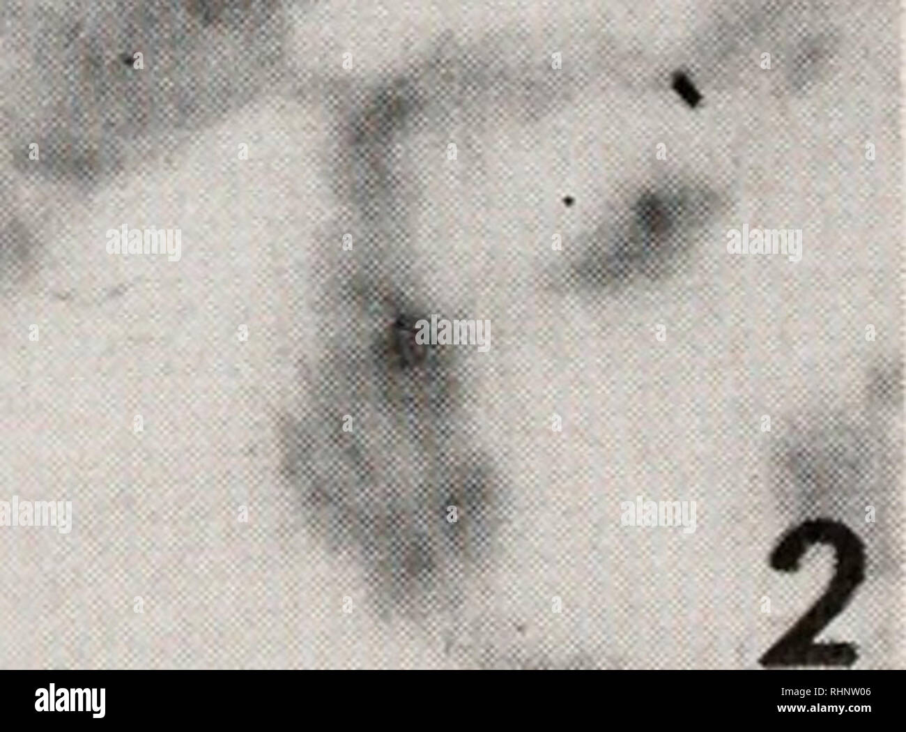 Retinula hi-res stock photography and images - Alamy