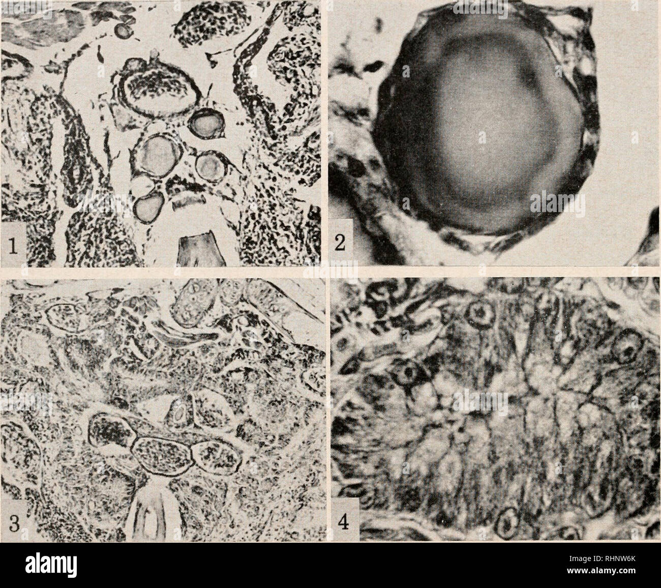 Flattened squamous epithelial cell hi-res stock photography and images ...