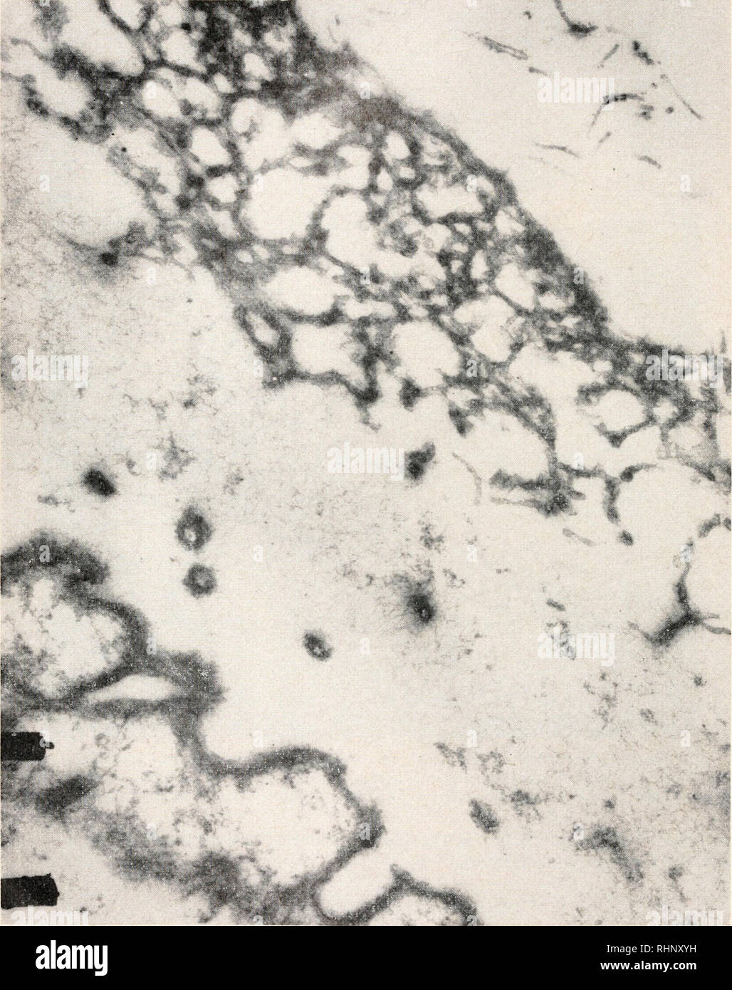 Collagen fibers electron micrograph hi-res stock photography and images ...