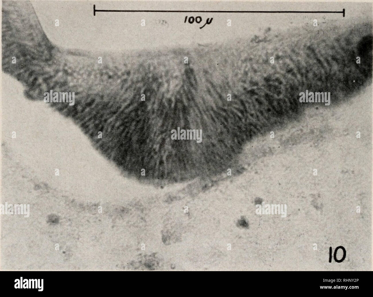 Negative phase contrast hi-res stock photography and images - Alamy