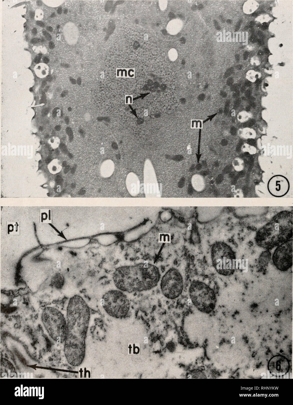 Trichocyst hi-res stock photography and images - Alamy