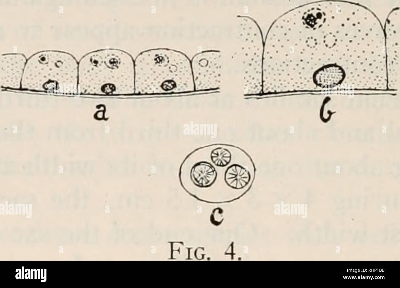 Renal bodies hi-res stock photography and images - Alamy