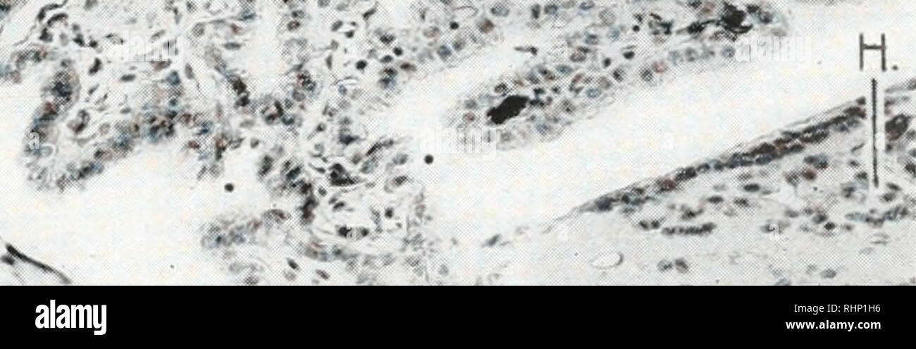 Paraventricular nucleus hi-res stock photography and images - Alamy