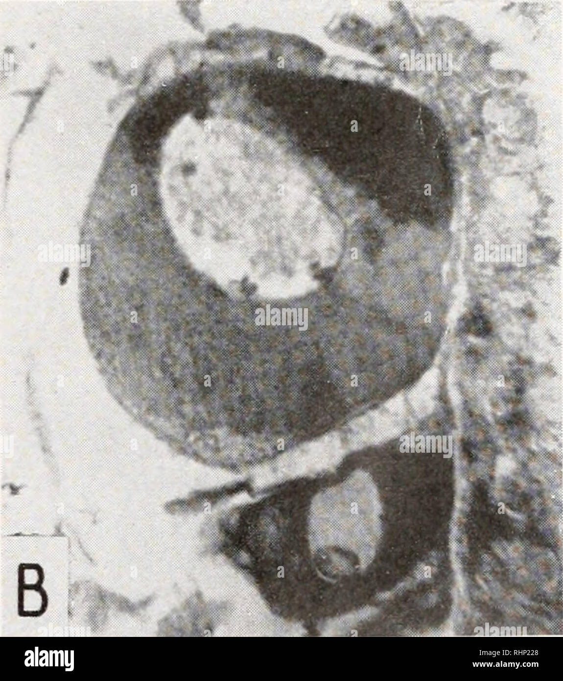 Hyaloplasm hi-res stock photography and images - Alamy
