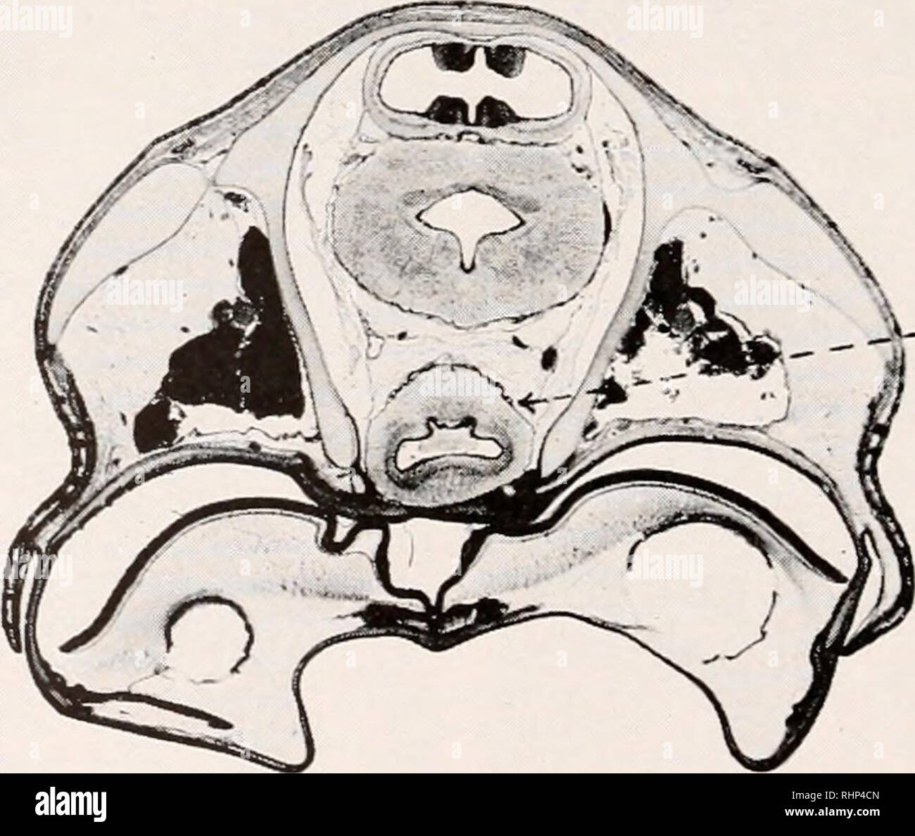 Pars distalis hi-res stock photography and images - Alamy