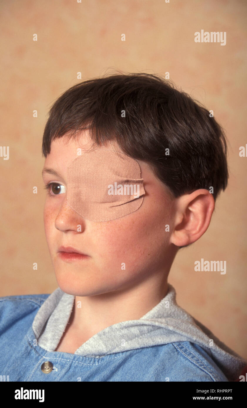 young boy wearing eye dressing Stock Photo - Alamy