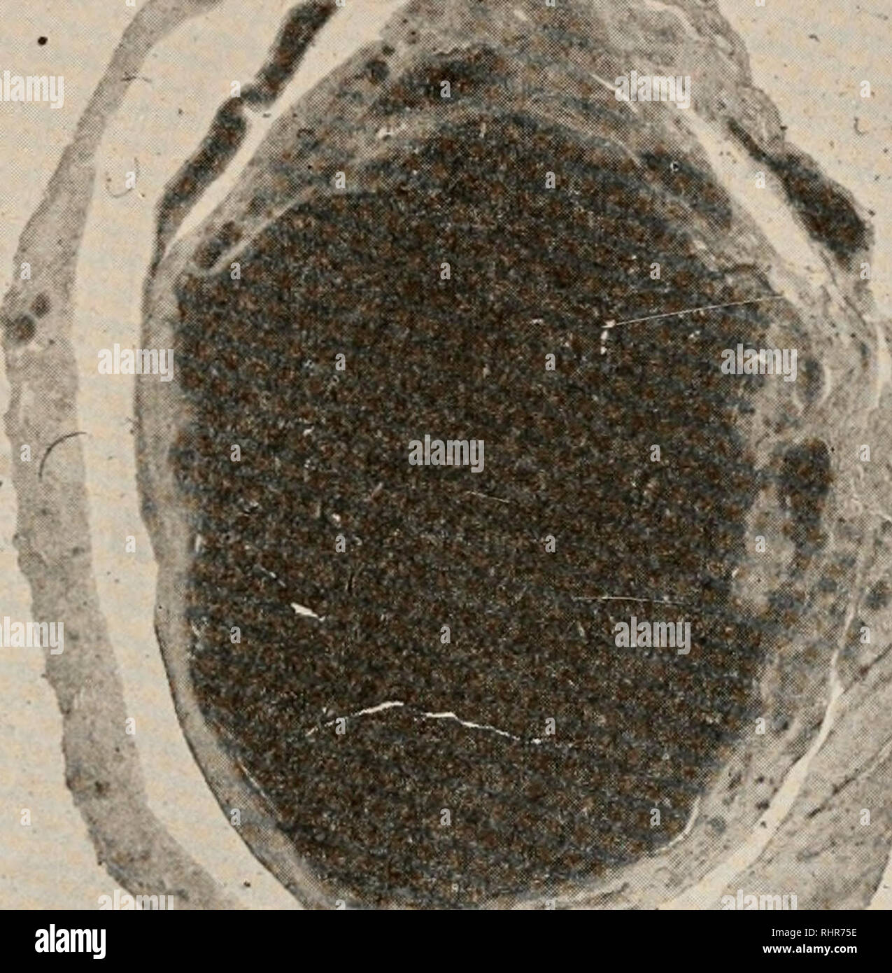 Decidua capsularis hi-res stock photography and images - Alamy