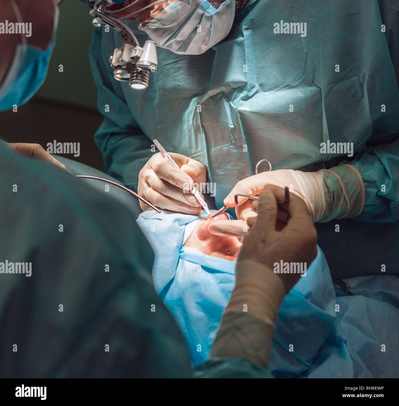 Cosmetic surgery on nose. The surgeon cuts the flesh Stock Photo - Alamy