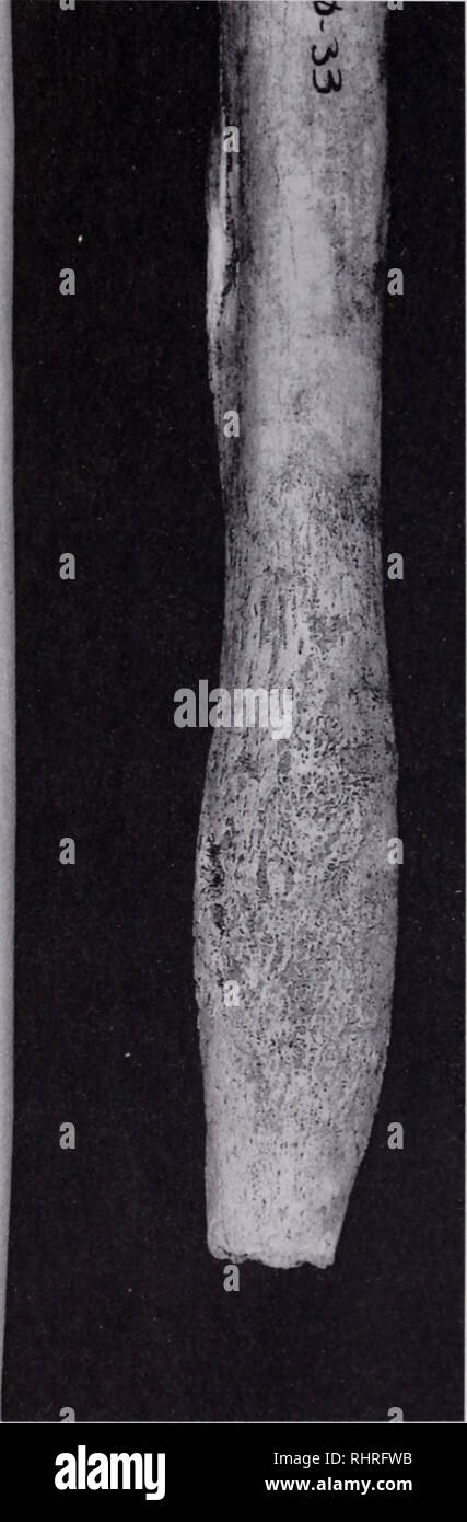 . Bioarchaeology of the late prehistoric Guale : South End Mound I, St ...