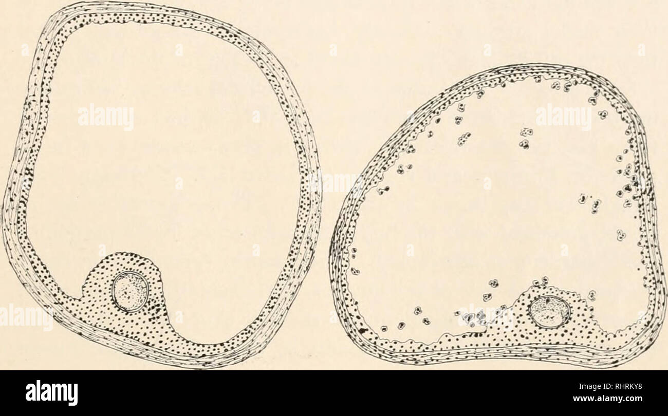 Follicle atresia hi-res stock photography and images - Alamy