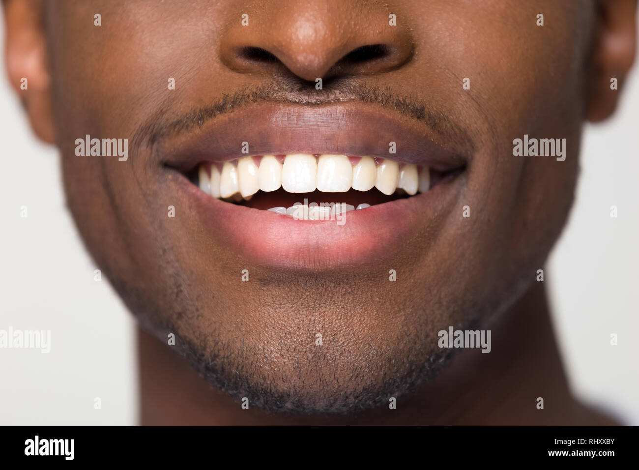 Close up view of beaming orthodontic white wide male smile Stock Photo ...