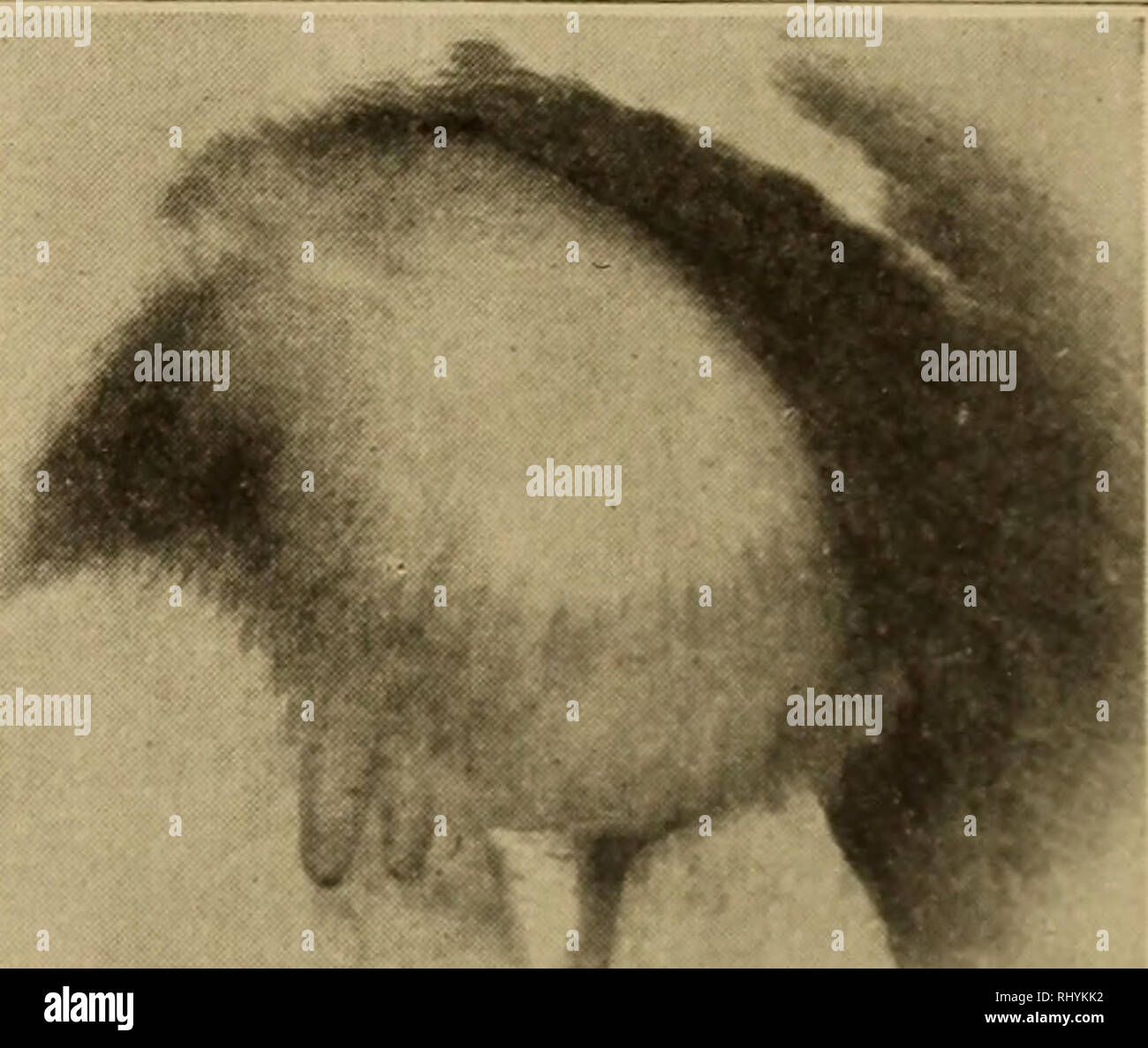 Milk producing gland hi-res stock photography and images - Alamy