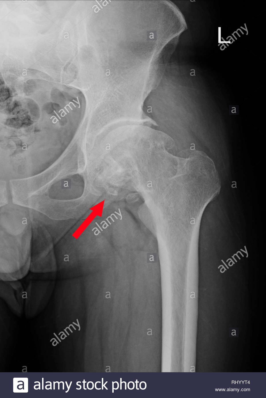 Pelvic Exam Stock Photos & Pelvic Exam Stock Images - Alamy