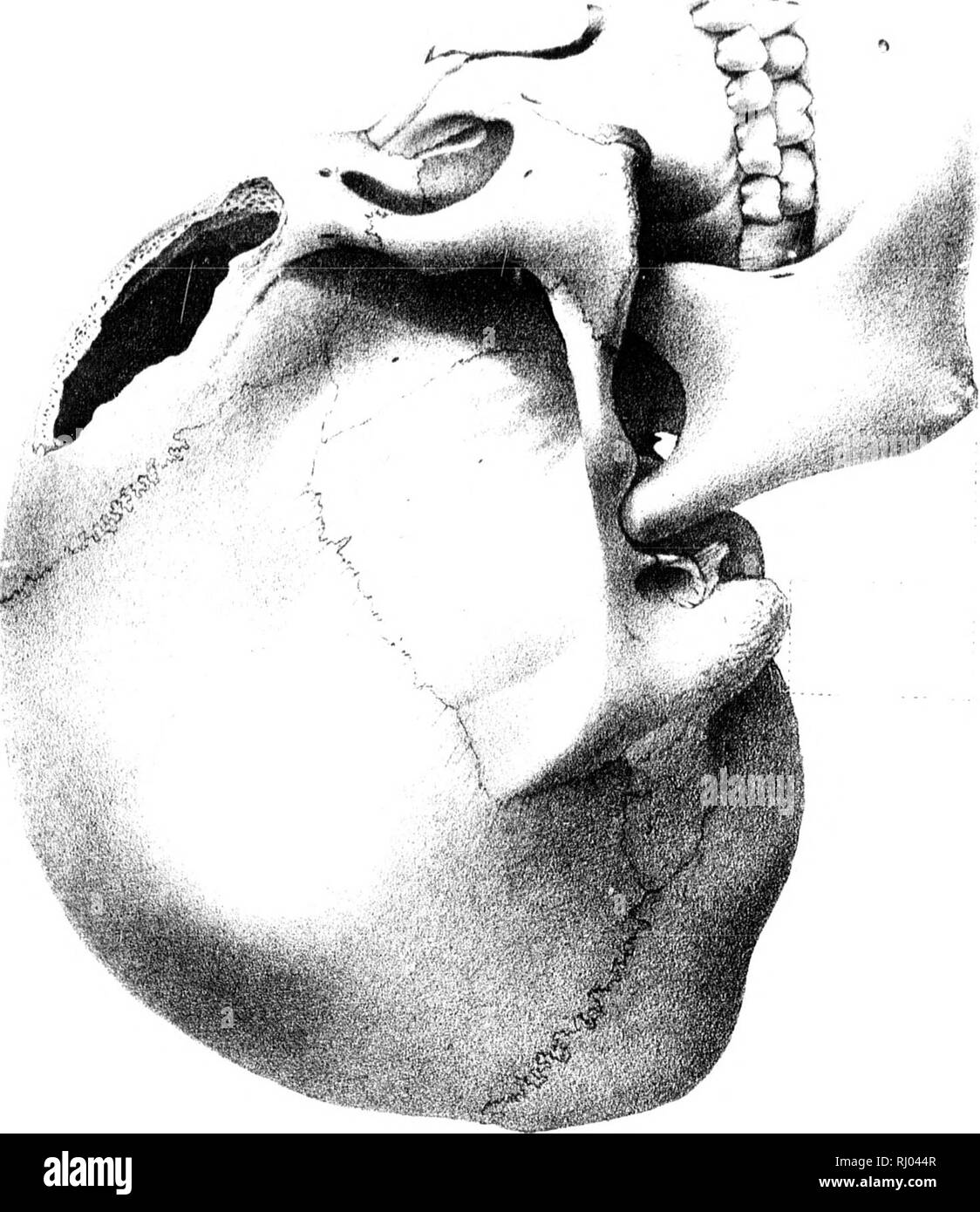 . Crania americana, or, A comparative view of the skulls of various ...