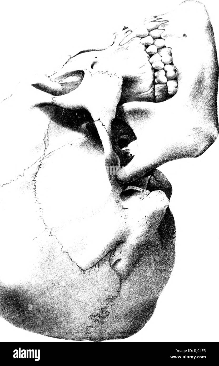 . Crania americana, or, A comparative view of the skulls of various ...