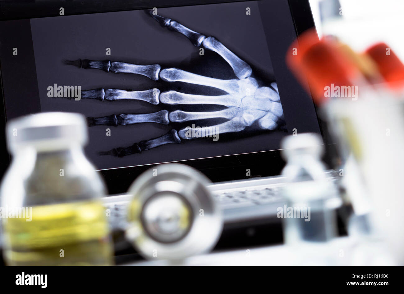Hand radiography in hospital, conceptual image Stock Photo - Alamy