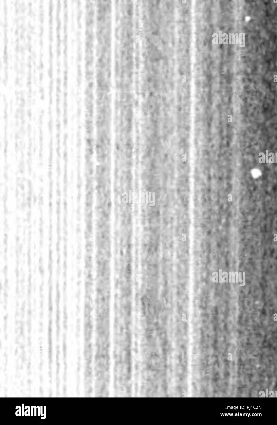 Lower jaw angles hi-res stock photography and images - Alamy