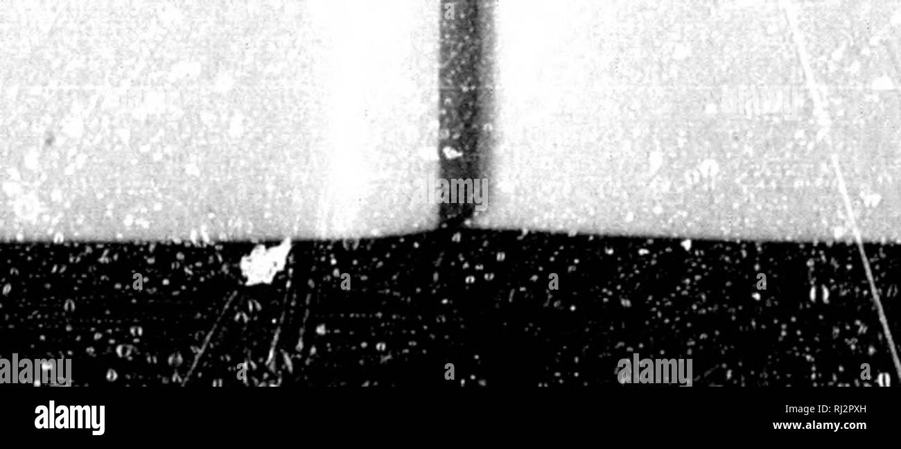 Anterior tubercles Black and White Stock Photos & Images - Alamy