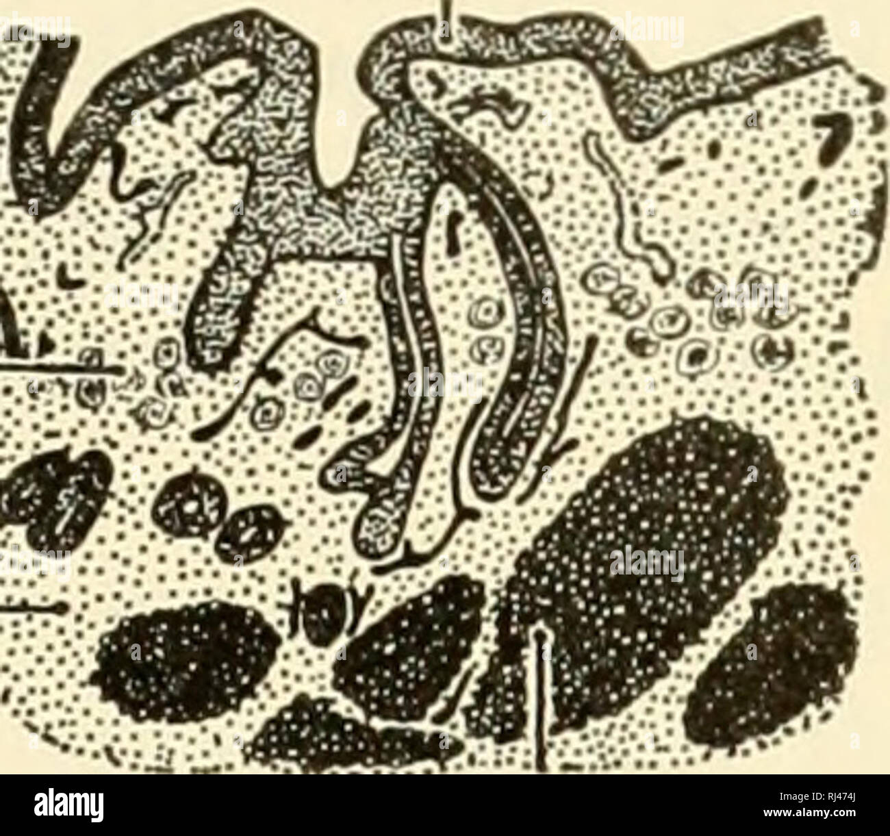 Left anterior axillary line hi-res stock photography and images - Alamy